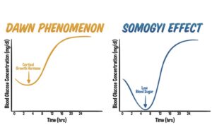 Unveiling the Differences: The Dawn Phenomenon vs. The Somogyi Effect ...