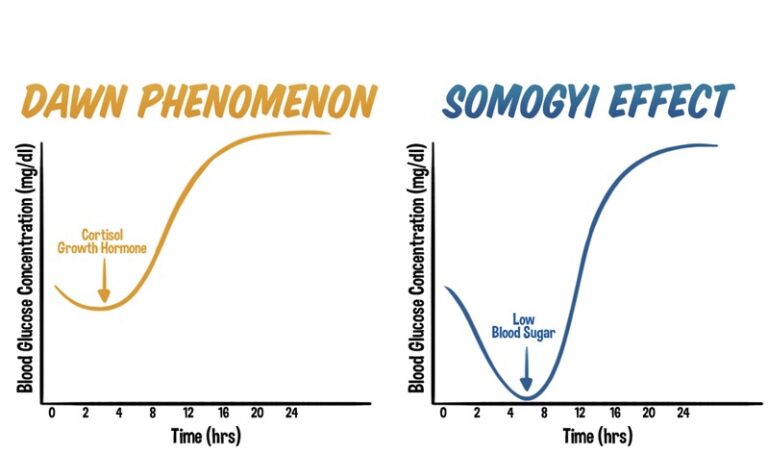 Unveiling the Differences: The Dawn Phenomenon vs. The Somogyi Effect ...